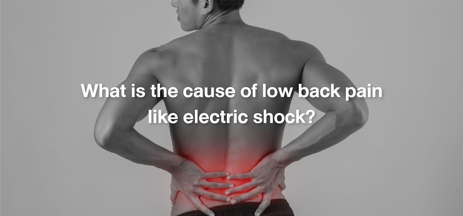 What is the cause of low back pain like electric shock? - Pain Clinic ...